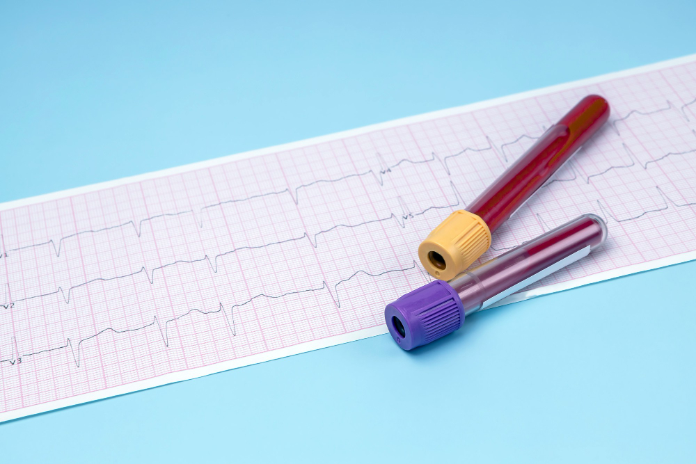 Cardiac Profile: A Simple Way to Know Your Heart’s Strength - kamineni ...